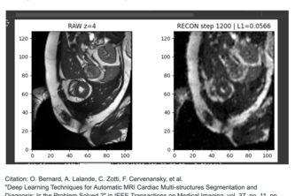 NIfTI 4D Visualizer with frame insertion | Devpost