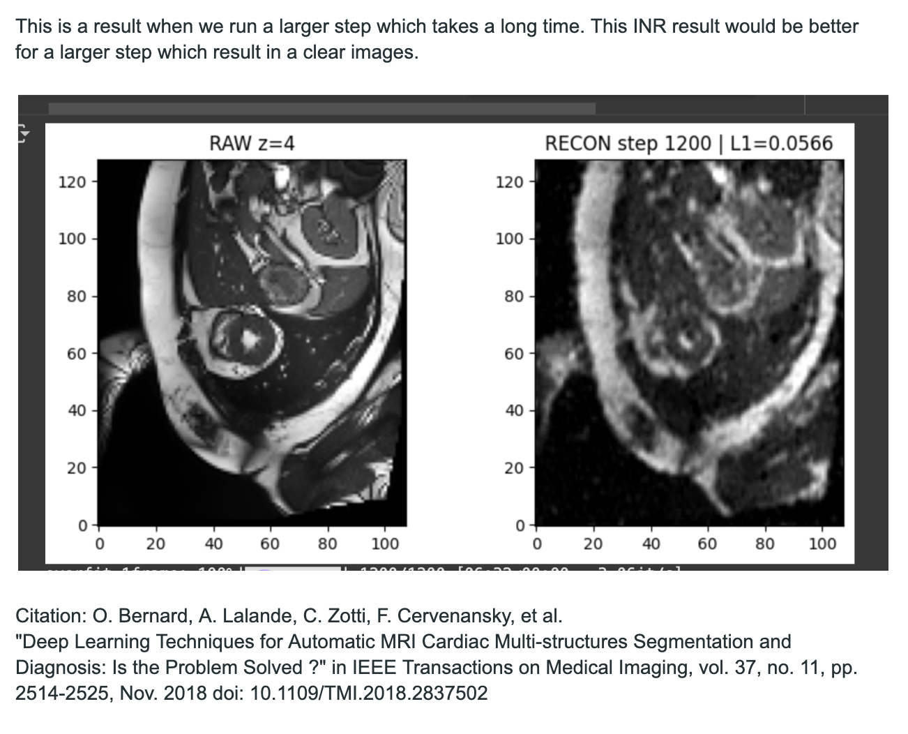 NIfTI 4D Visualizer with frame insertion | Devpost