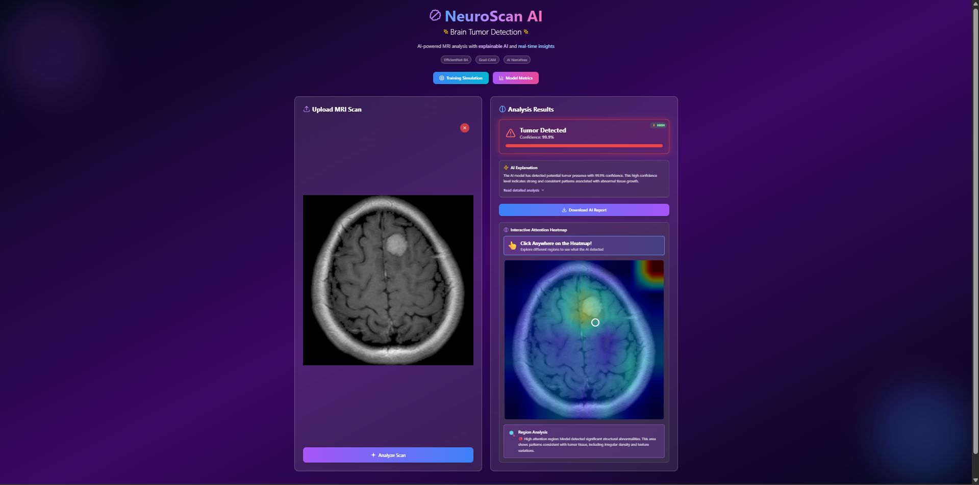 NeuroScan AI- Brain Tumor Detection | Devpost