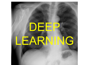 Deep Residual Learning for Classification of X-Rays | Devpost