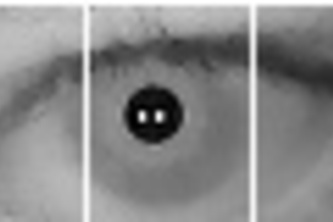 Wheelchair Movement Using Eyeball Detection | Devpost