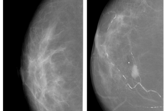 Rad-Assist | Devpost