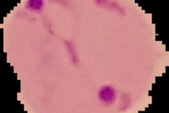 Malaria Detection System | Devpost