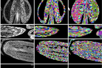 Plant Cell Segmentation with a Convolutional Neural Network | Devpost