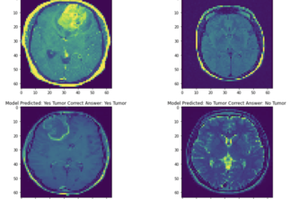 AI Disease Detection | Devpost