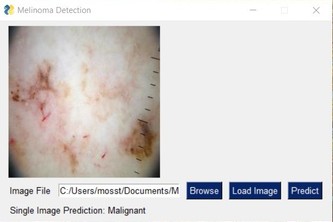 Melanoma diagnosis | Devpost