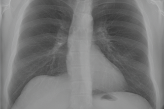 This X-Ray Does Not Exist | Devpost