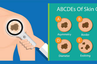 SkinCancerDetector | Devpost