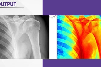 X-Ray Colorization by using image processing | Devpost