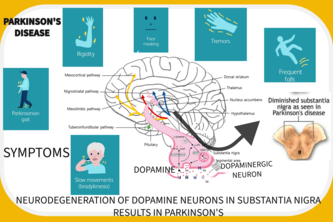 Parkinson's disease Predictor | Devpost
