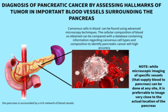 (Pancreatic) Cancer Predictor | Devpost