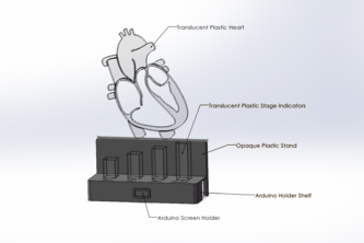 Congestive Heart Failure Educational Model | Devpost