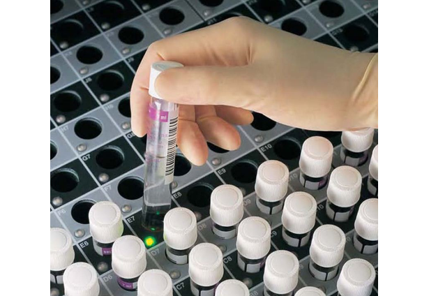 Becton Dickinson: BD MGIT Technology | USPTO Patents For Humanity