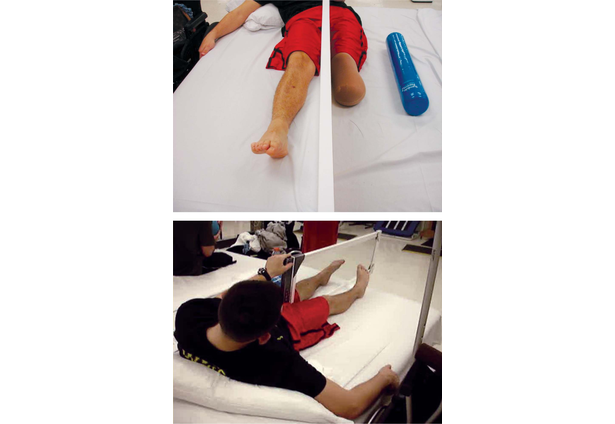 Mirror Therapy for Phantom Limb Pain Treatment in Military Amputees ...