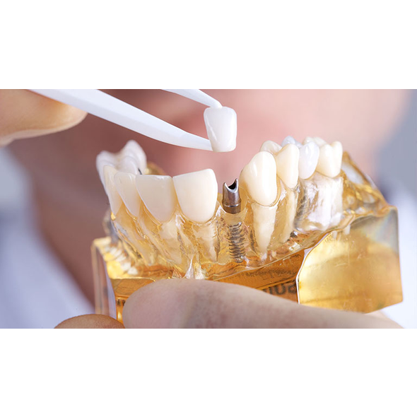 Trồng Răng Implant's (trongrangimplant-ads) software portfolio | Devpost